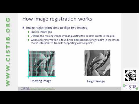 Lung Image Registration