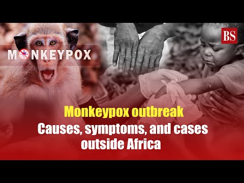 Monkeypox outbreak: Causes, symptoms, and cases outside Africa