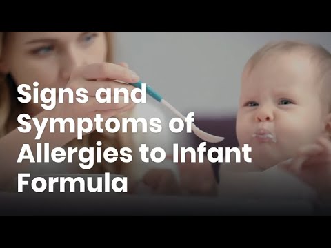 Signs and Symptoms of Allergies to Infant Formula