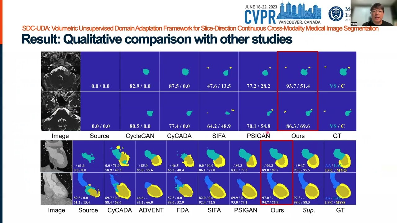 [CVPR 2023] SDC-UDA (8-Min Presentation Video)