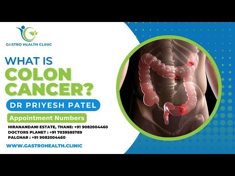 Dr Priyesh Patel | Gastroenterologist in Thane | Colon Cancer