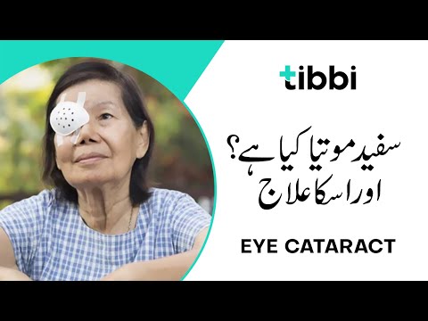 Treatment of Eye cataract | Sufaid motiye ka ilaj / Urdu / English tibbi