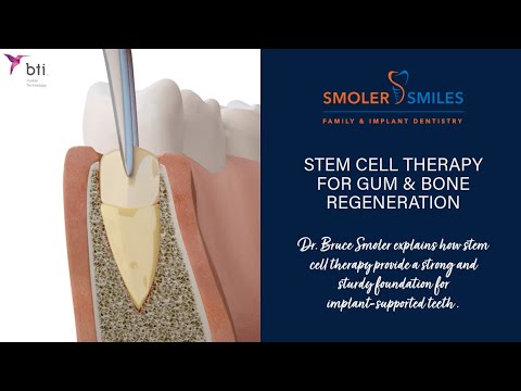 Stem Cell Therapy explained by Dr. Bruce Smoler