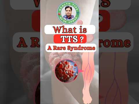 What is TTS ? A Rare Syndrome #shorts #youtubeshorts #ytshortsindia #shortsfeed