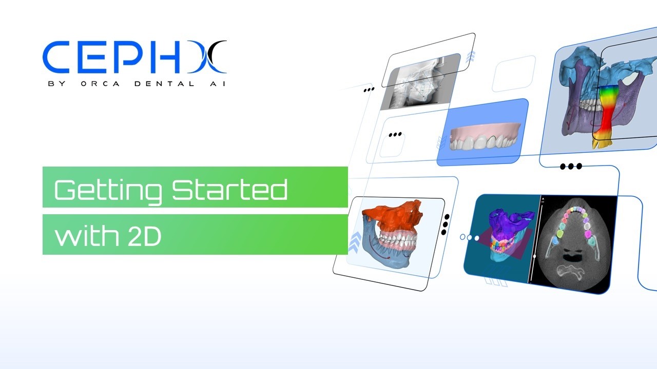 Getting started with CephX 2D