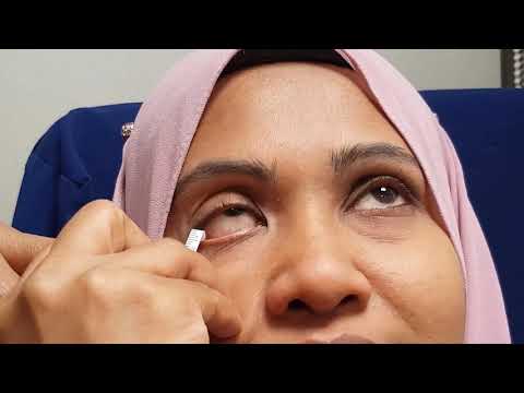 Schirmer’s 2 Test by Dr Niumah Fathmath (Maldives)