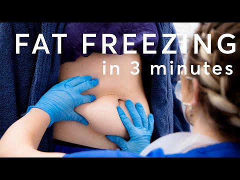 Fat Freezing in 3 minutes - What is CoolSculpting? - Body Sculpting Treatment