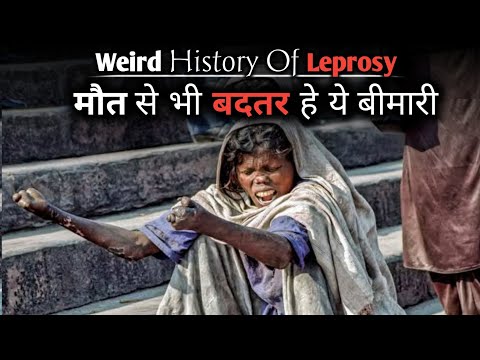Leprosy disease History in hindi | Leper Colonies
