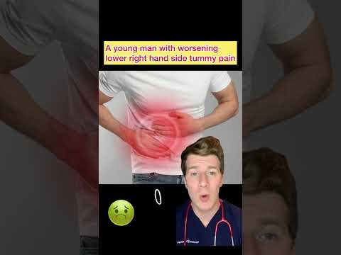A man with right sided lower abdominal pain…what’s the diagnosis? (PART 1) #shorts #medical #doctor