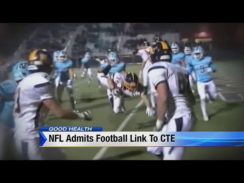 NFL admits football link to CTE