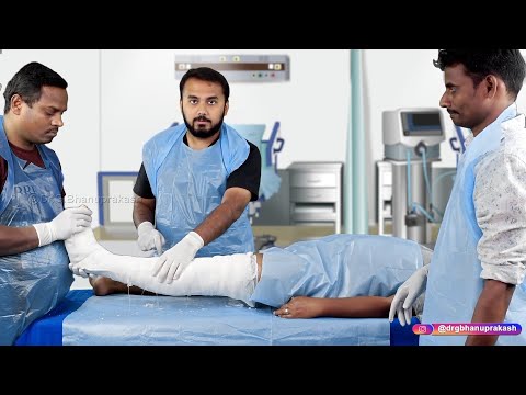 Plaster of Paris Slab Application Procedure : Clinical essentials