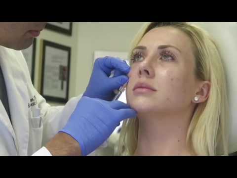 Lower eyelid fillers for under eye hollowing