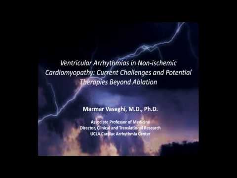 Ventricular Arrhythmias in Non-ischemic Cardiomyopathy March 8 2019