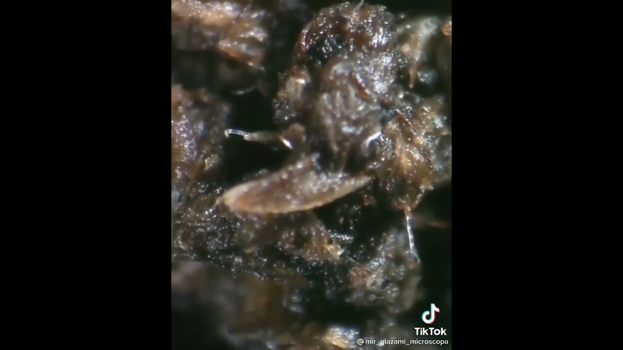 Microbes in the nails: microorganisms effects 2021