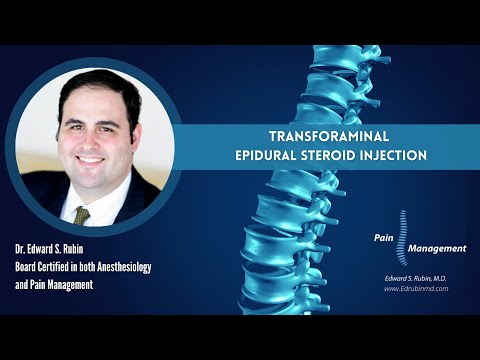 Transforaminal Epidural Steroid Injection