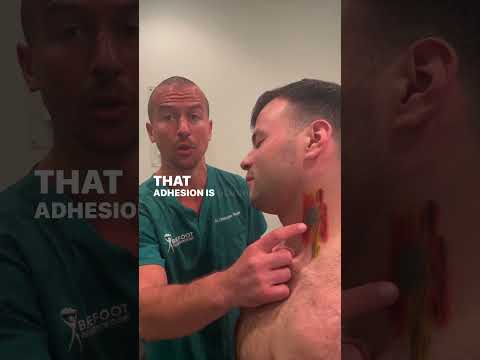 The most common spot for chronic #neckpain to check for adhesion