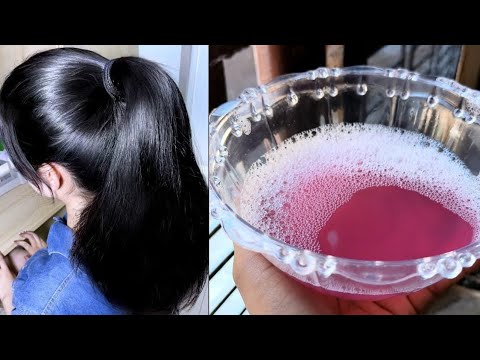 प्याज का तेल घर पर बनाएं बालों का गिरना, गंजेपन की समस्या सफेद बालों को हमेशा के लिए काला करें Hair