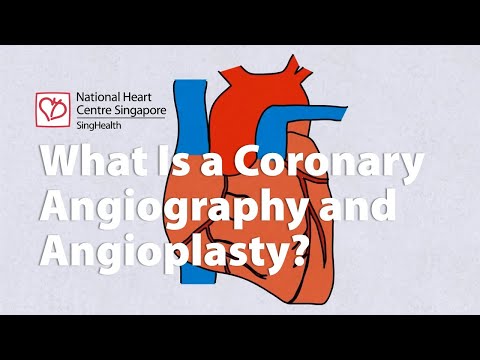 The lifesaving procedure you need to know about | All About Coronary Angiography