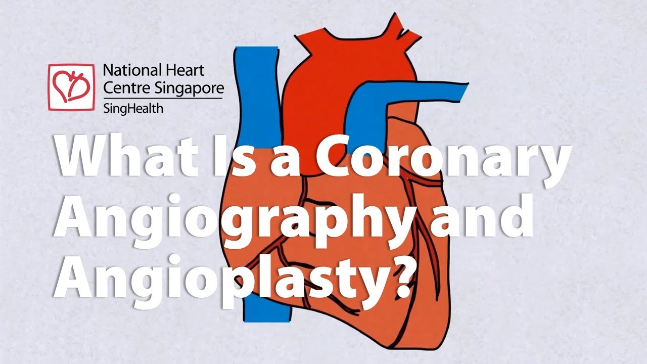 The lifesaving procedure you need to know about | All About Coronary Angiography