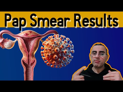 Pap Smear 101 - Explained. Pap Smear results meaning (Pap Test)