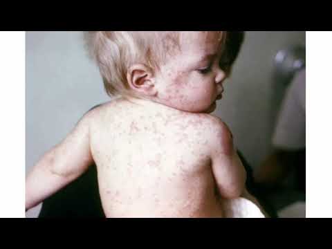 Viral Diseases in urdu and hindi|FSC part-1|Biology| Variety of life|@SchoolofZoology