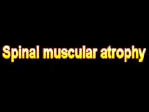 What Is The Definition Of Spinal muscular atrophy Medical School Terminology Dictionary