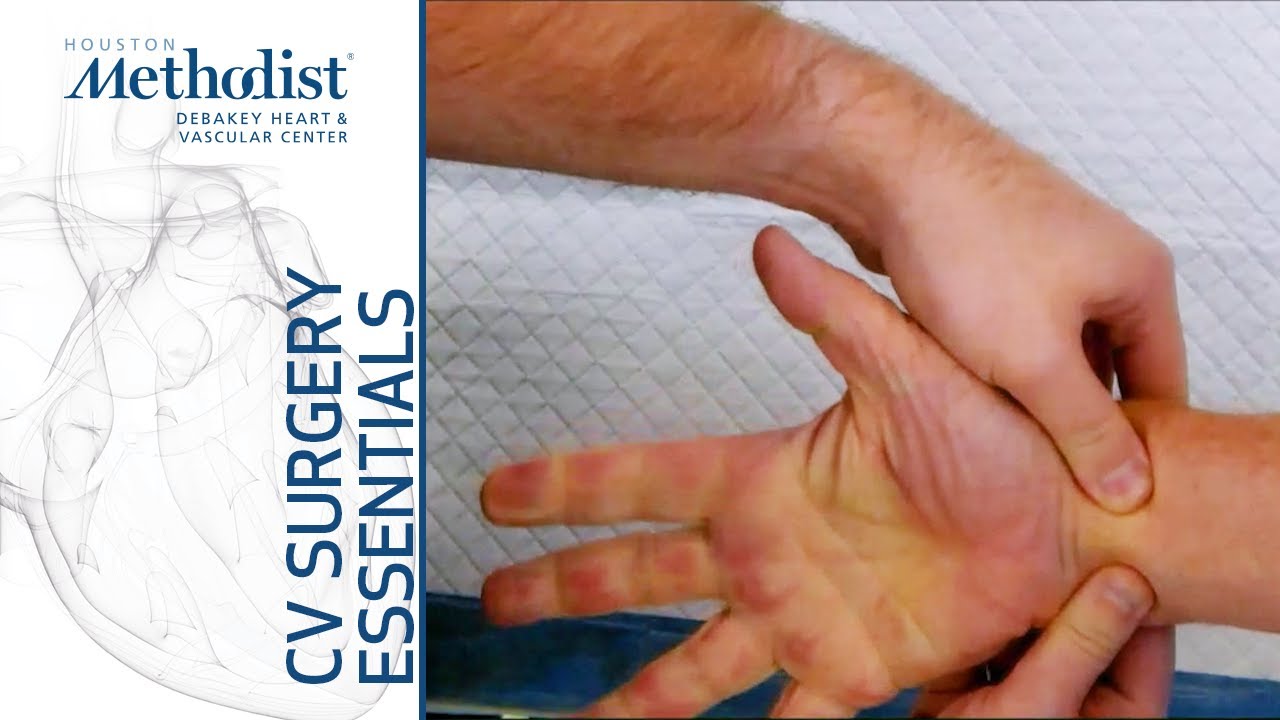 How to Perform an Allen Test (Alan B. Lumsden, MD, Cara Chasin, MD)