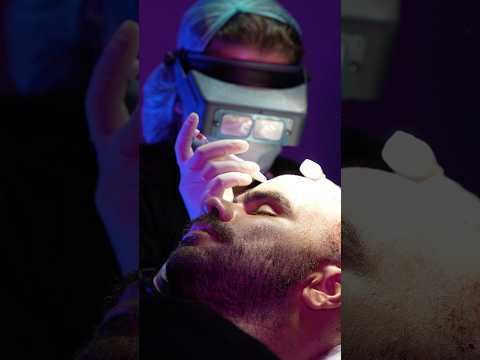 Cosmedica Clinic Hair Transplant in Turkey #shorts #hairtransplant #video