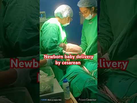 Newborn baby delivery by cesarean section #cesareanbirth #newbornbaby #deliveryboy#gynecologist