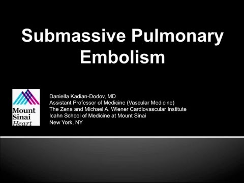 SIR-RFS Webinar (7/2/14): Submassive PE
