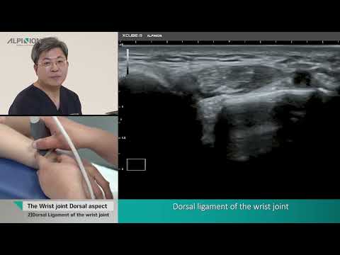 Musculoskeletal Ultrasound (Wrist and Hand) 02.Wrist_Dorsal aspect