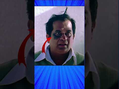 కమిలిన గాయం