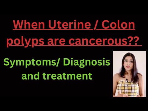 When Uterine/ Colon polyps are cancerous? Symptoms/ Diagnosis/Treatment