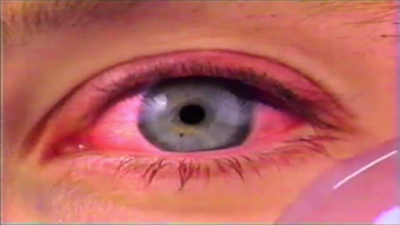 Envision Contact Lenses