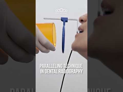 Paralleling technique in dental radiography #dentalbean