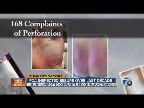 FDA inspected Essure over last decade