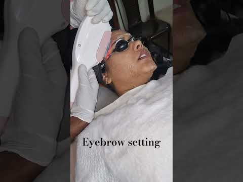 permanent eyebrow setting #laser #skincare #baldnes #skinmarks #laserhairreduction
