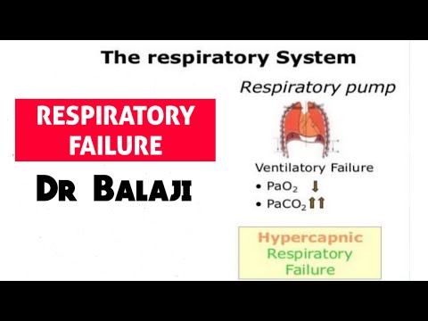 Type 2 Respiratory Failure Causes || Mechanism || Treatment || NIF / MIP / P 0.1 explained Dr Balaji