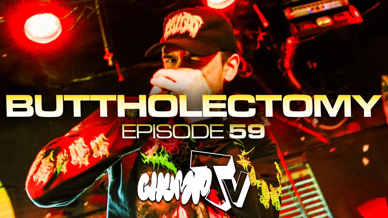 CHUMPTV : EP59 - BUTTHOLECTOMY