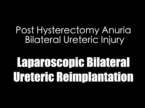 Post Hysterectomy Anuria Bilateral Ureteric Injury Laparoscopic Bilateral Ureteric Reimplantation
