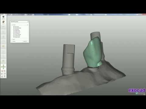 New version Dynamic Titanium Bases Library