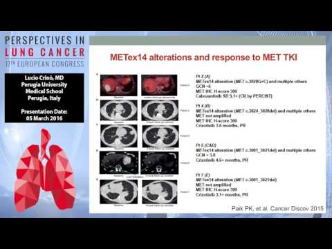 Extreme Rare Mutations in Lung Cancer (ROS1, TRK, HER2): Treatment opportunities