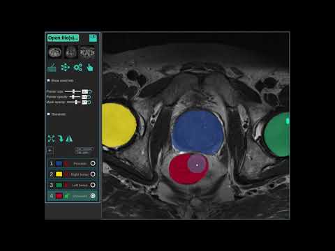 How to create your own radiology quiz