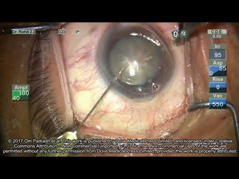 Supplementary Video 2 ID 147510