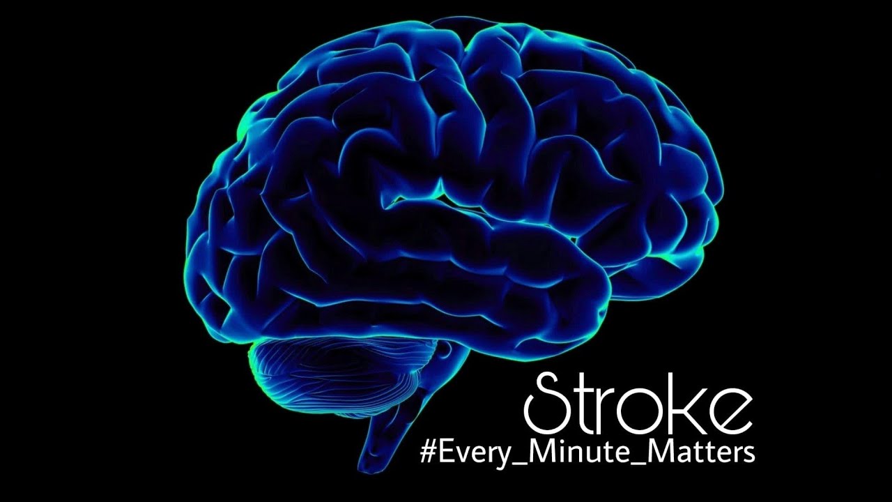 Stroke Awareness - World Stroke Day 2021