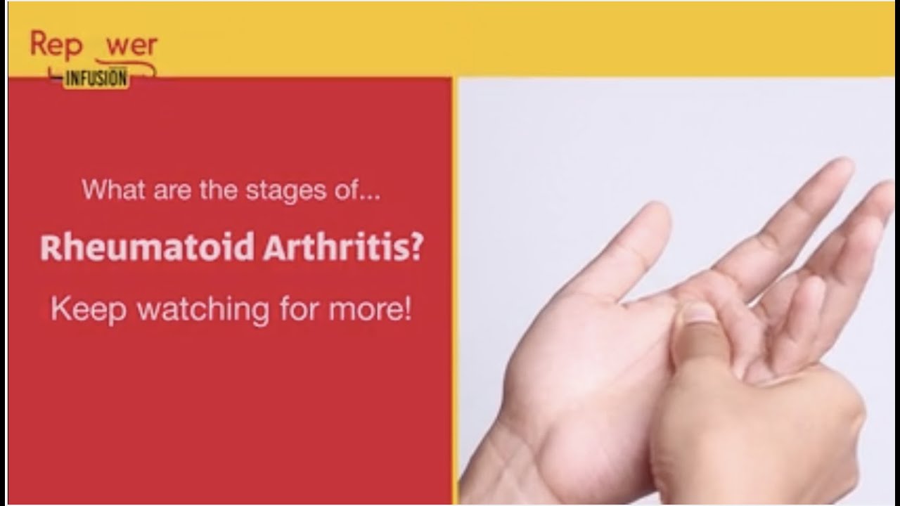 The Stages of Rheumatoid Arthritis