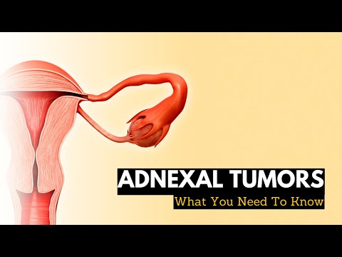 Adnexal Tumors: What You Need To Know