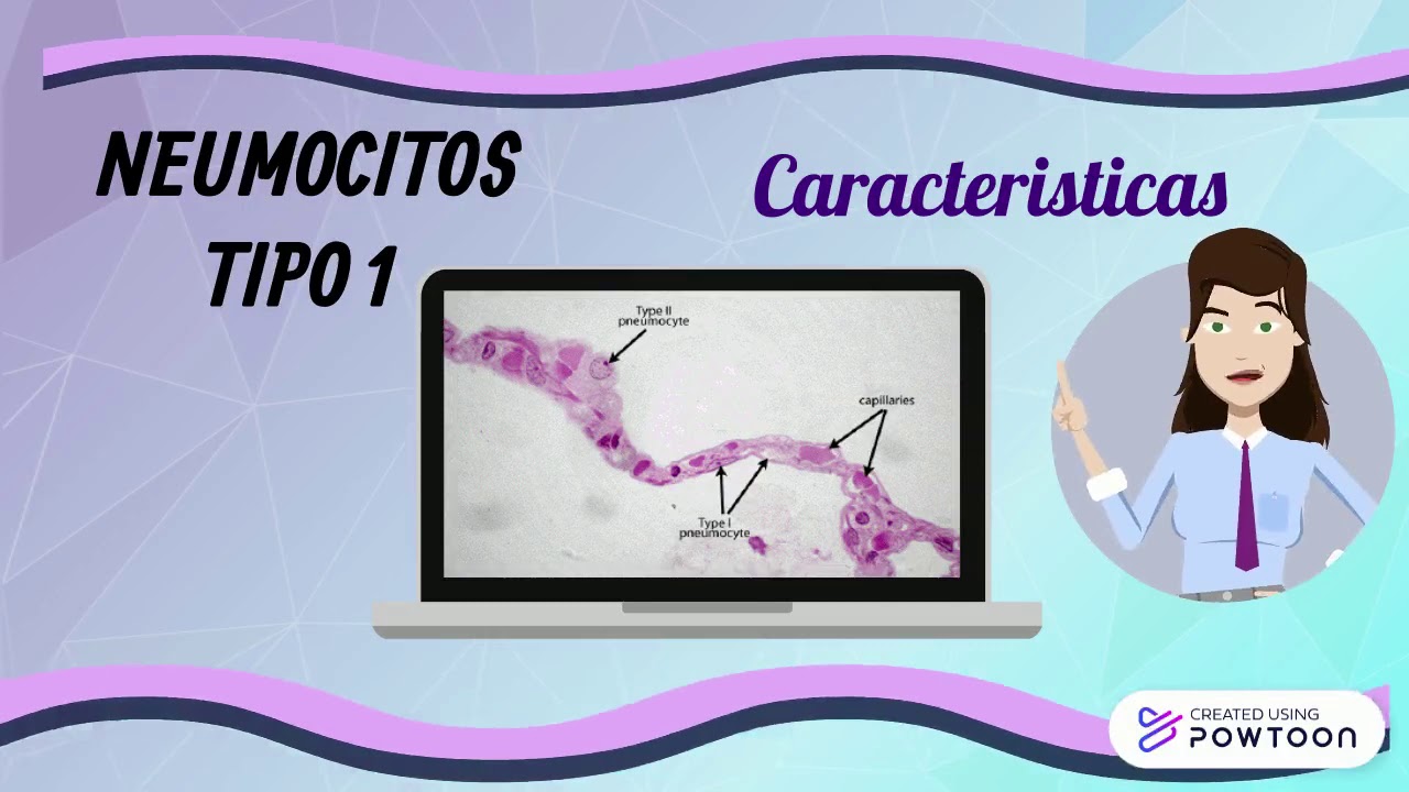 LOS NEUMOCITOS