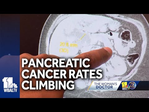 Woman's Doctor: Pancreatic cancer rates climbing among younger women