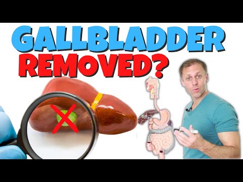 How Digestion Changes After Gallbladder Removal